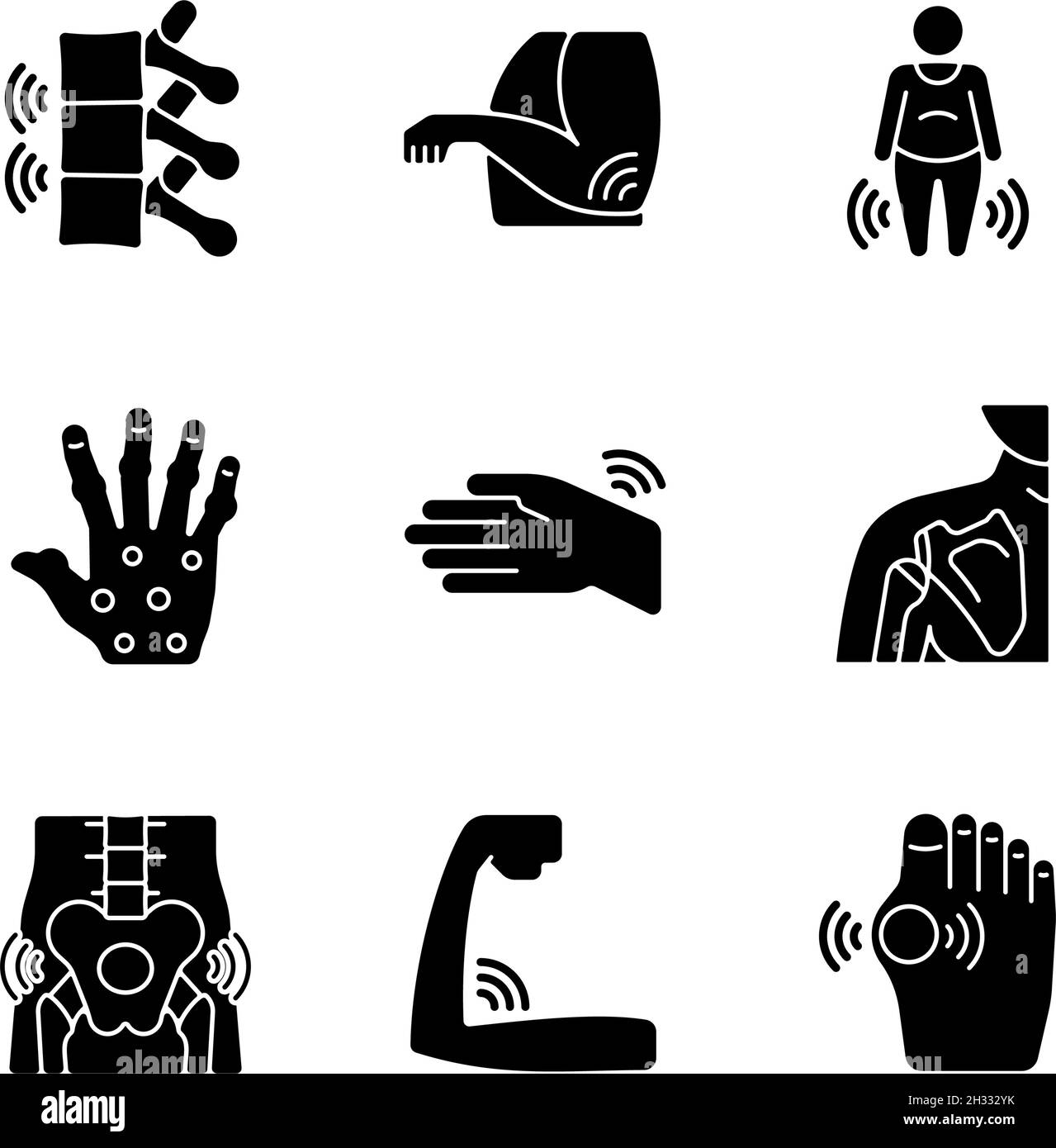 Vector design bone inflammation Black and White Stock Photos & Images ...