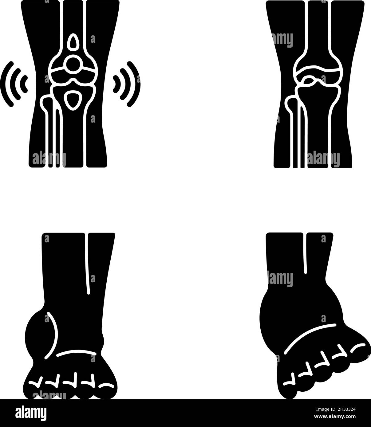 Arthritis leg pain black glyph icons set on white space Stock Vector ...