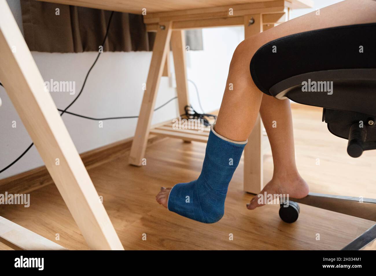 Woman leg cast hi-res stock photography and images - Alamy