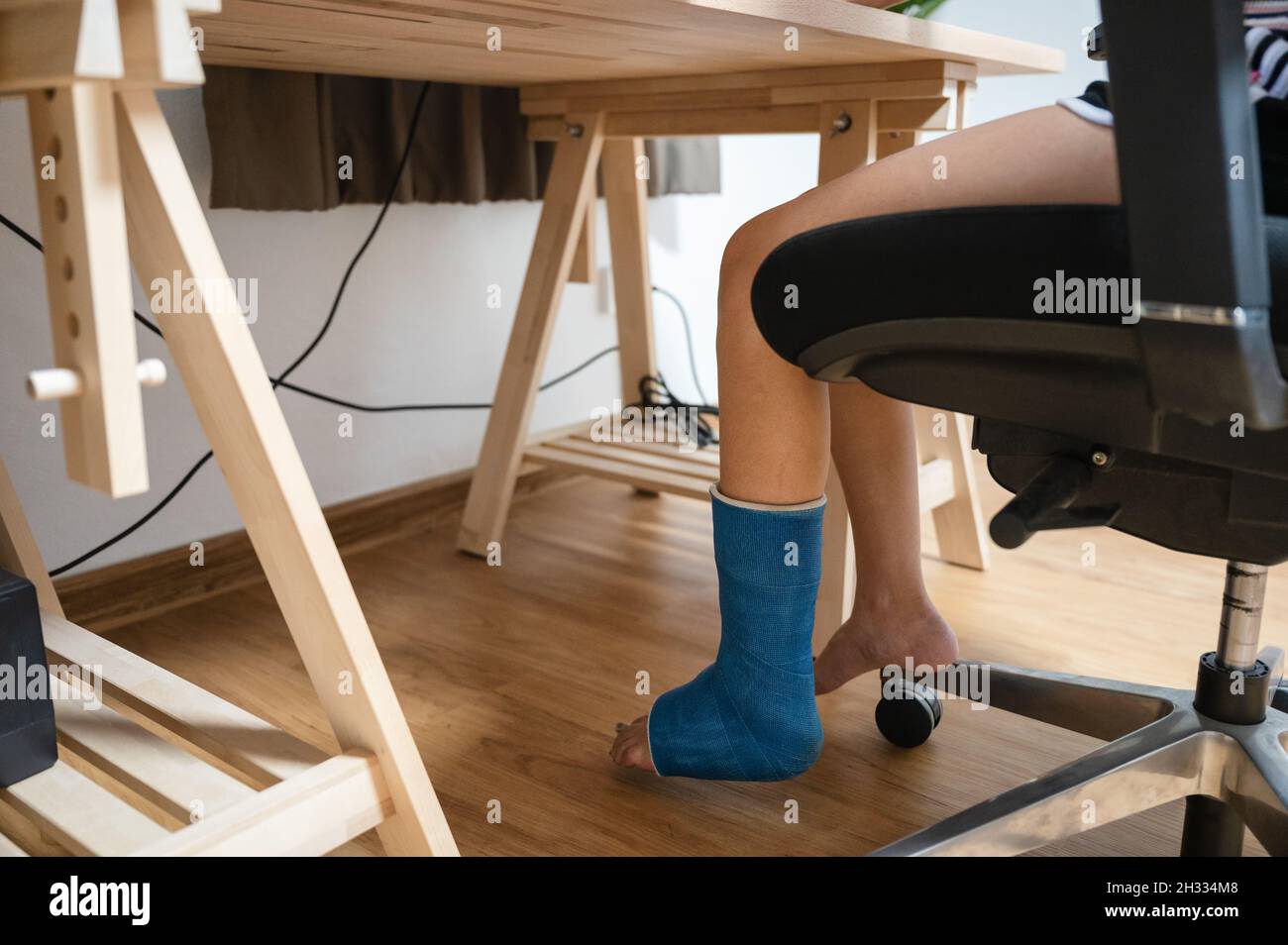 Leg in plaster cast hi-res stock photography and images - Alamy