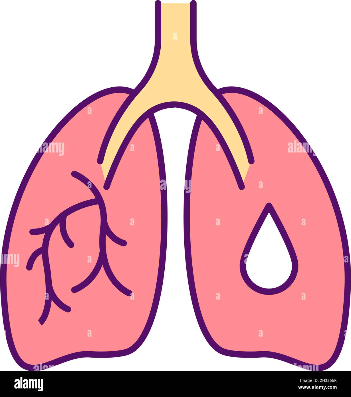 Phlegm buildup in lungs RGB color icon Stock Vector Image & Art - Alamy