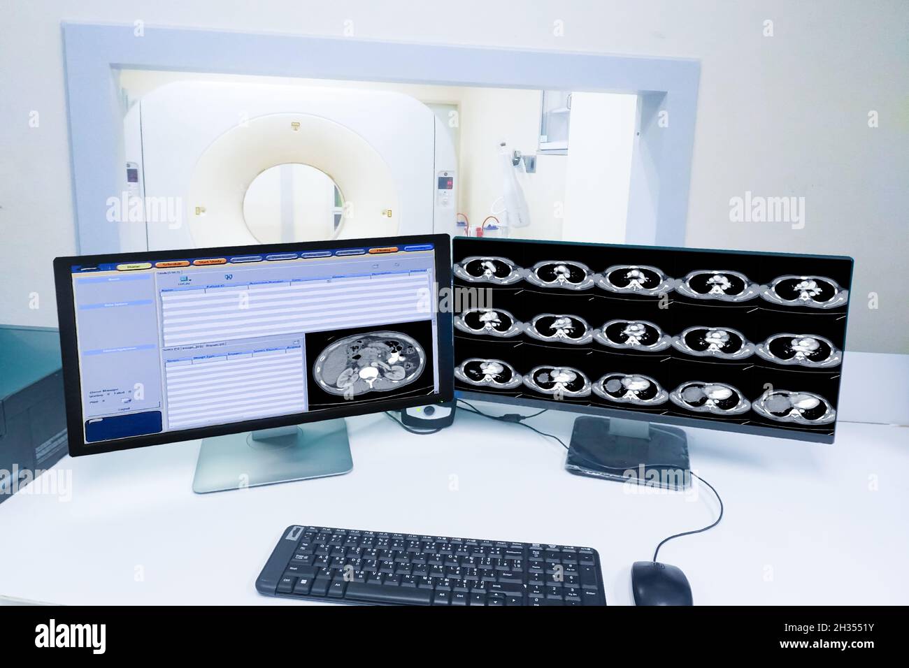 Computer monitor Scan control room and computer showing abdominal scan ...
