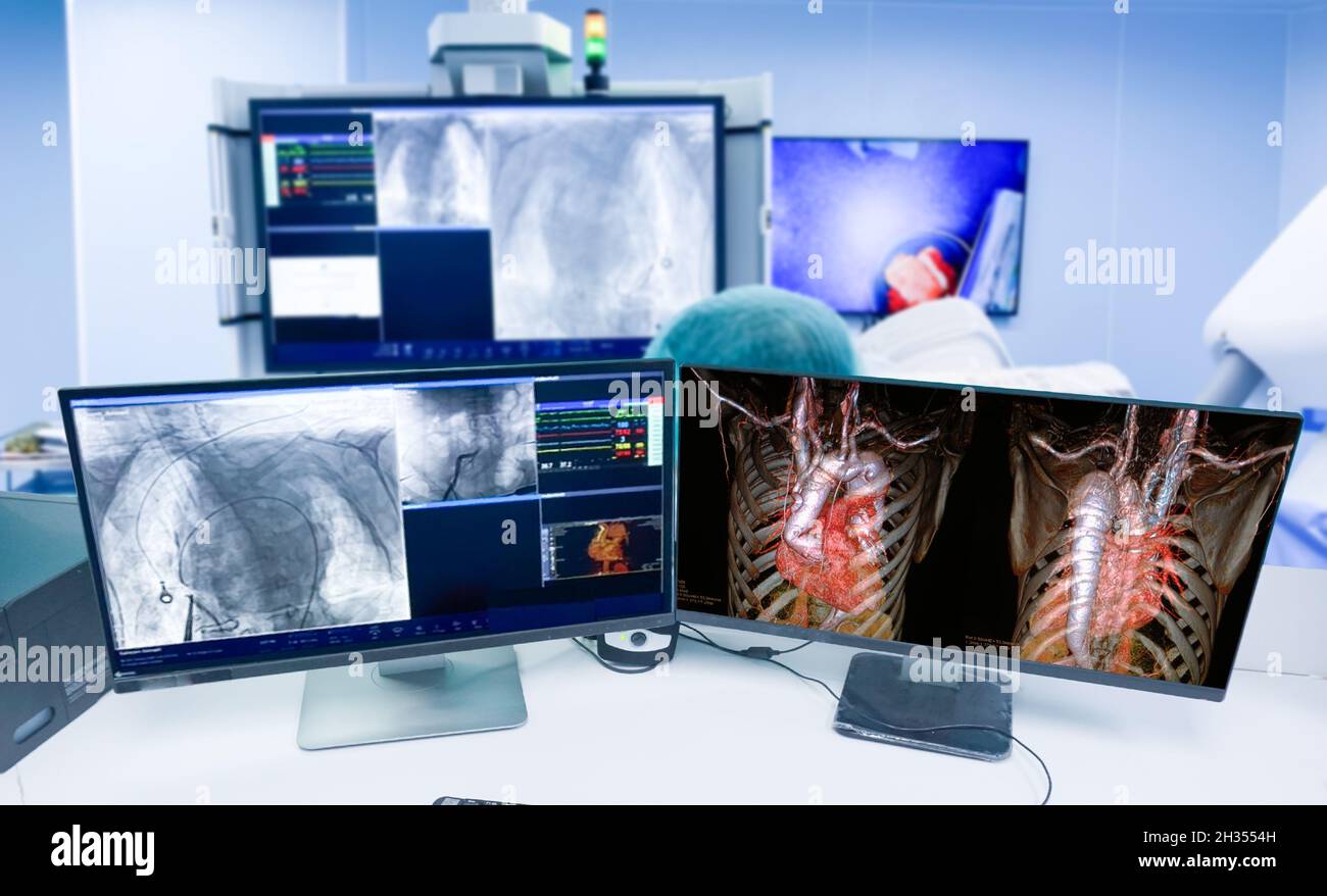 Hospital x ray room monitor screen hi-res stock photography and images ...