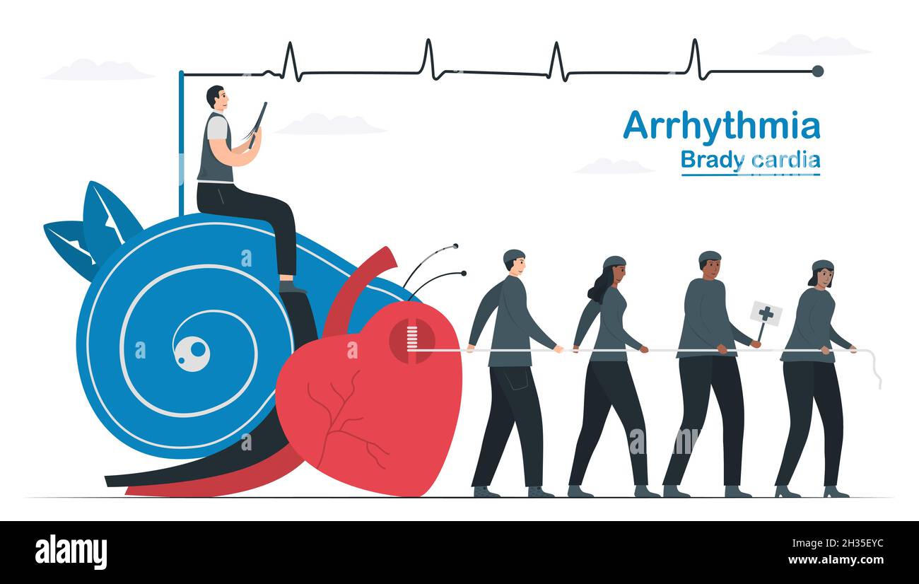 This heart disease problem is bradycardia arrhythmia. Diagnostic and ...
