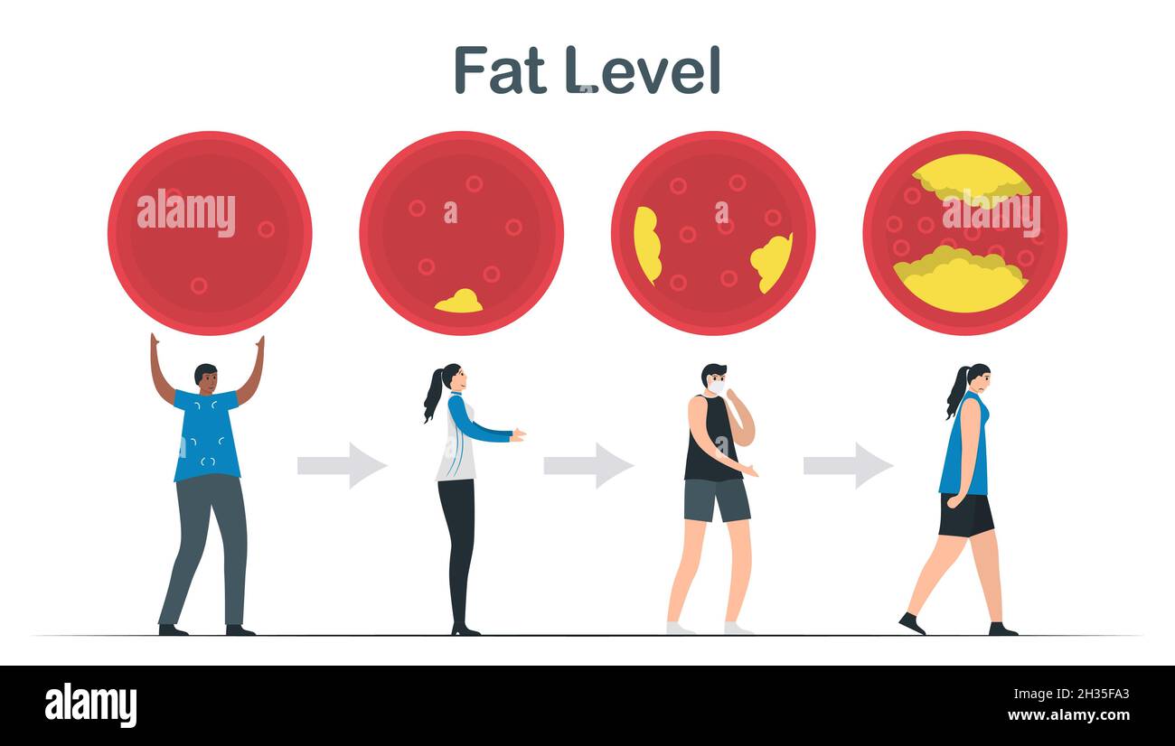 Fat cells in blood Stock Vector Images - Alamy