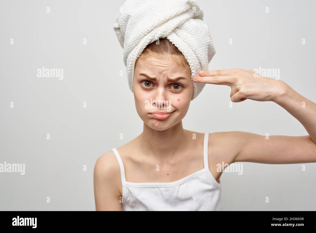 woman with a towel on my head skin problems close-up Stock Photo - Alamy