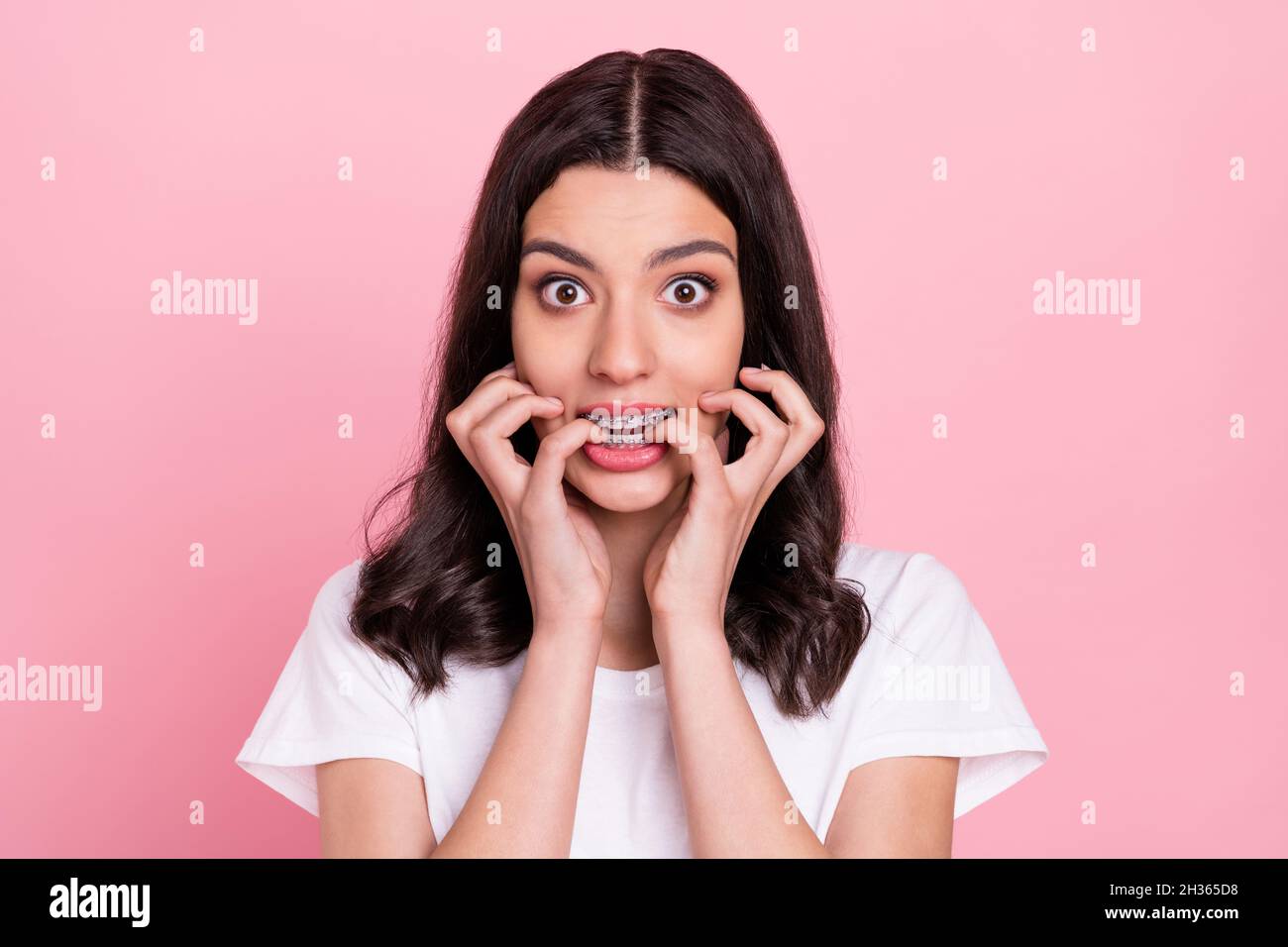 Photo of young scared nervous woman bite nails fingers teeth braces ...