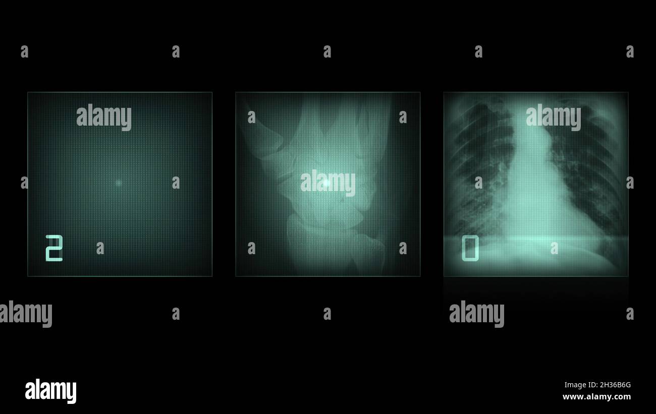 Ray on illuminator panel hi-res stock photography and images - Alamy