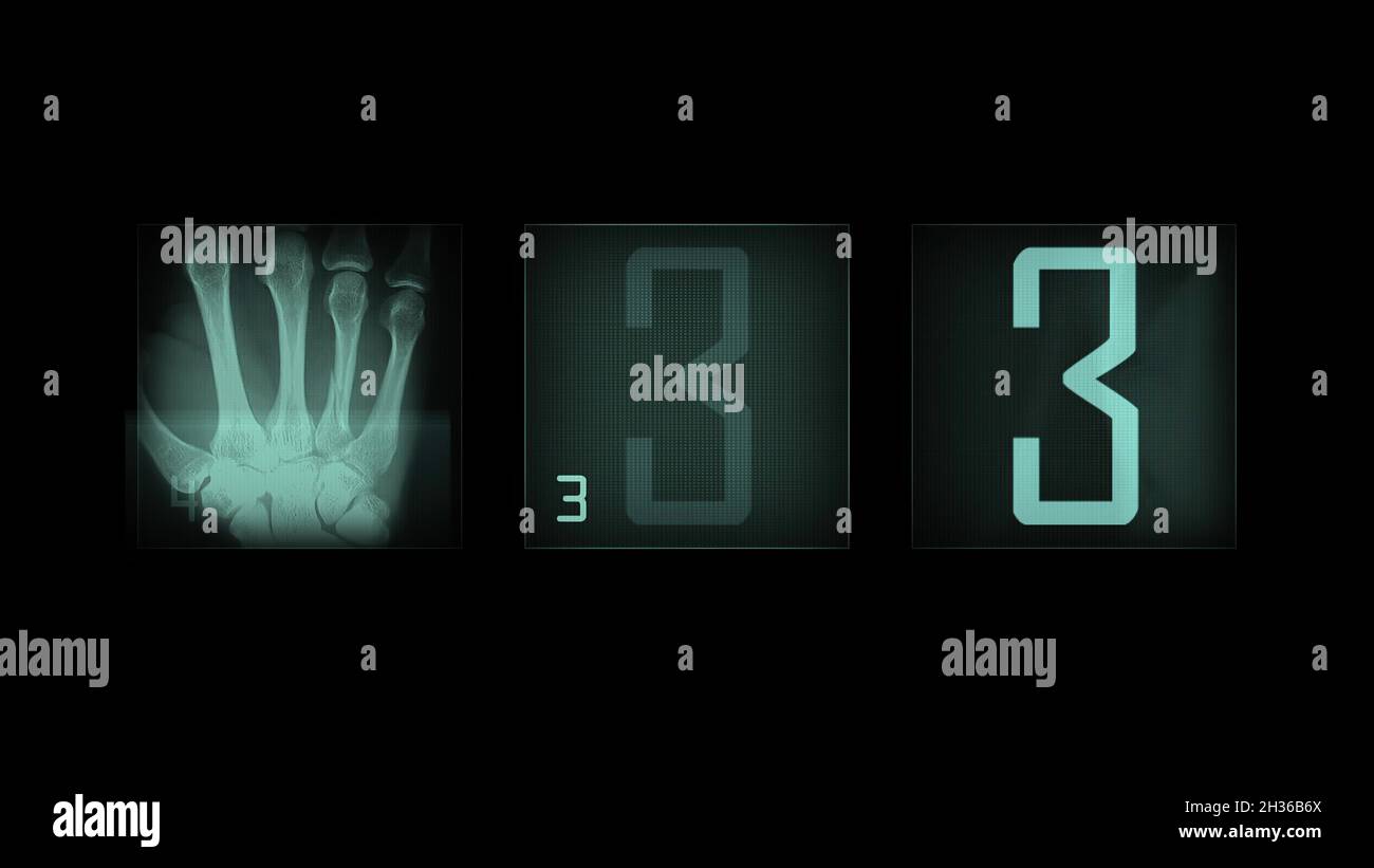 3d illustration - x-ray panels on black background Stock Photo - Alamy
