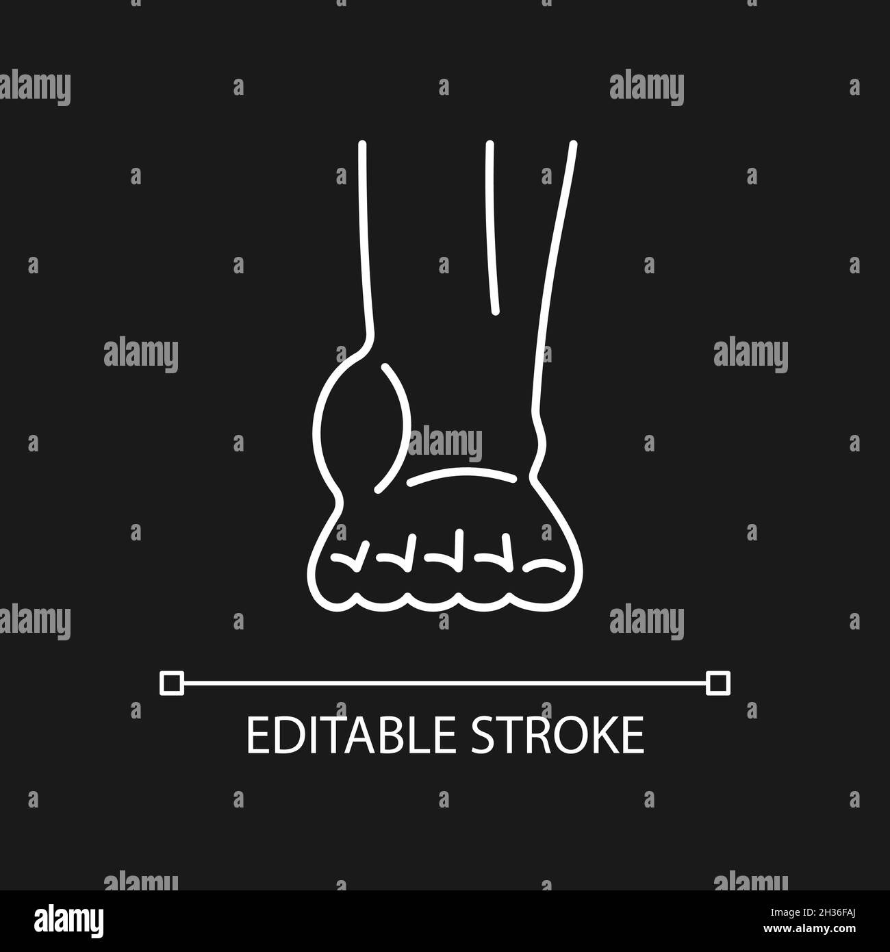 Ankle inflammation white linear icon for dark theme Stock Vector Image ...