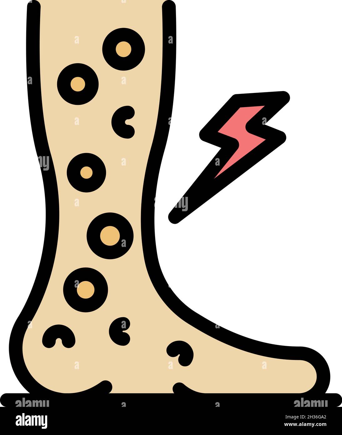 Erythematous vector vectors hi-res stock photography and images - Alamy