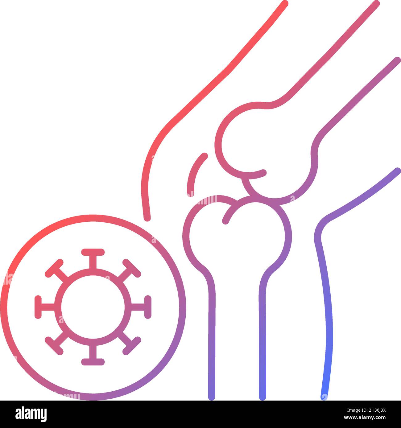 Reactive arthritis gradient linear vector icon Stock Vector Image & Art ... Reactive arthritis gradient linear vector icon Stock Vector Image & Art ...