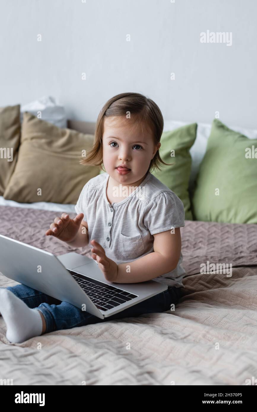 Toddler kid with down syndrome looking at camera near laptop on blurred ...