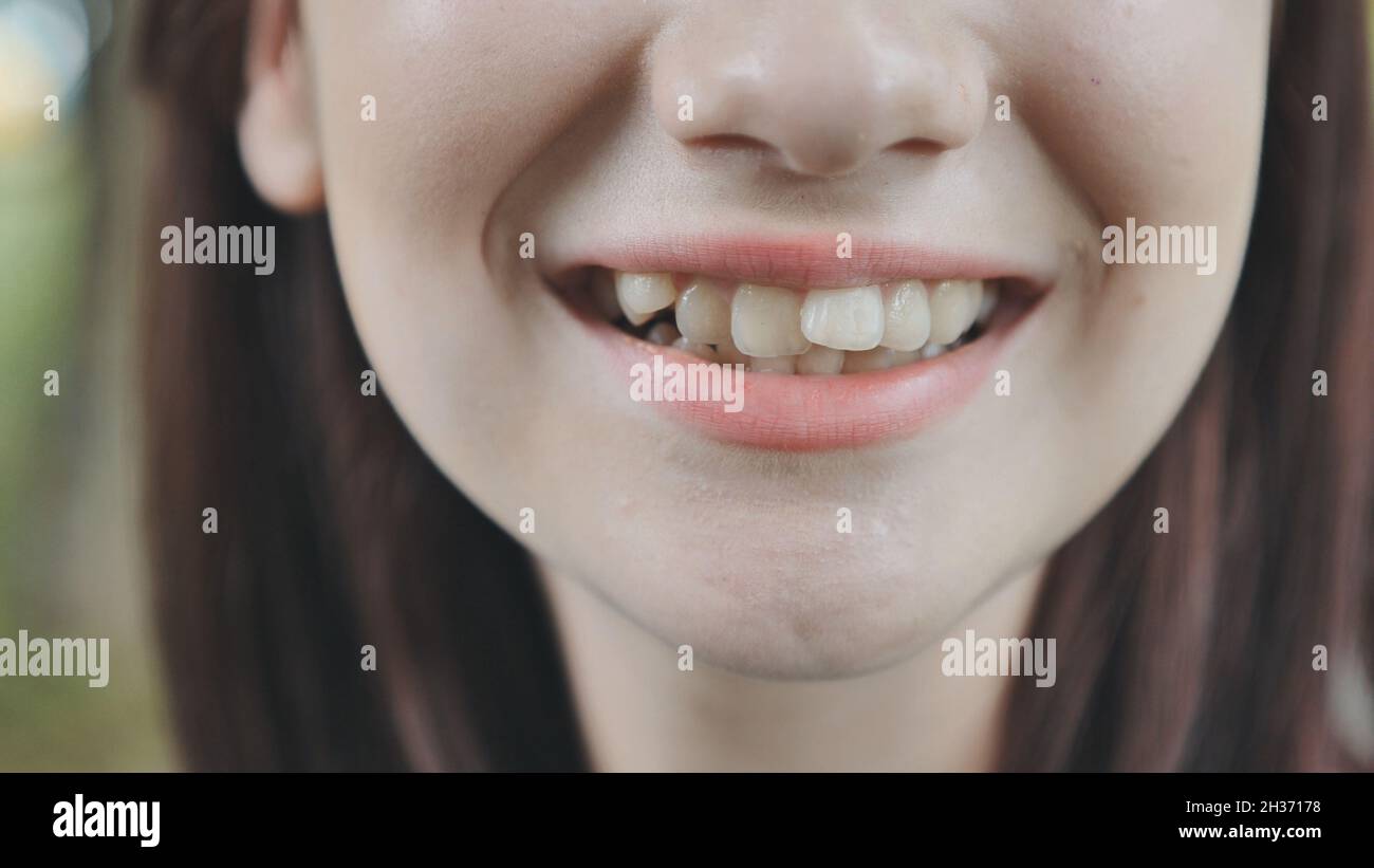 A teenage girl demonstrates her crooked teeth Stock Photo - Alamy