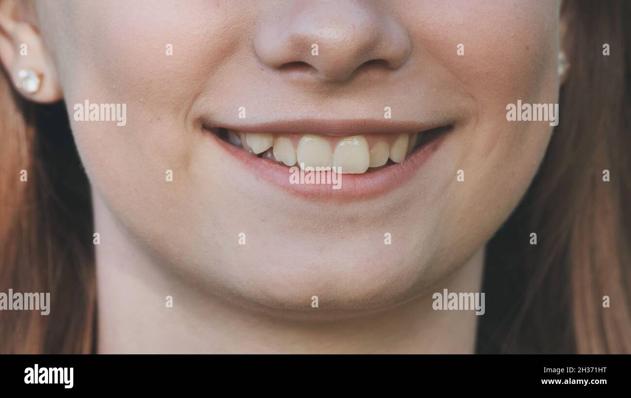 A young girl smiles and shows her crooked teeth Stock Photo - Alamy