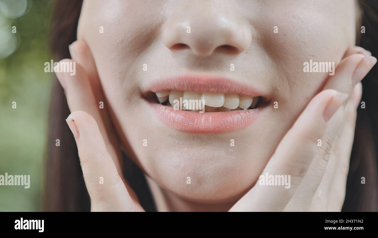 A teenage girl demonstrates her crooked teeth by opening her mouth and ...