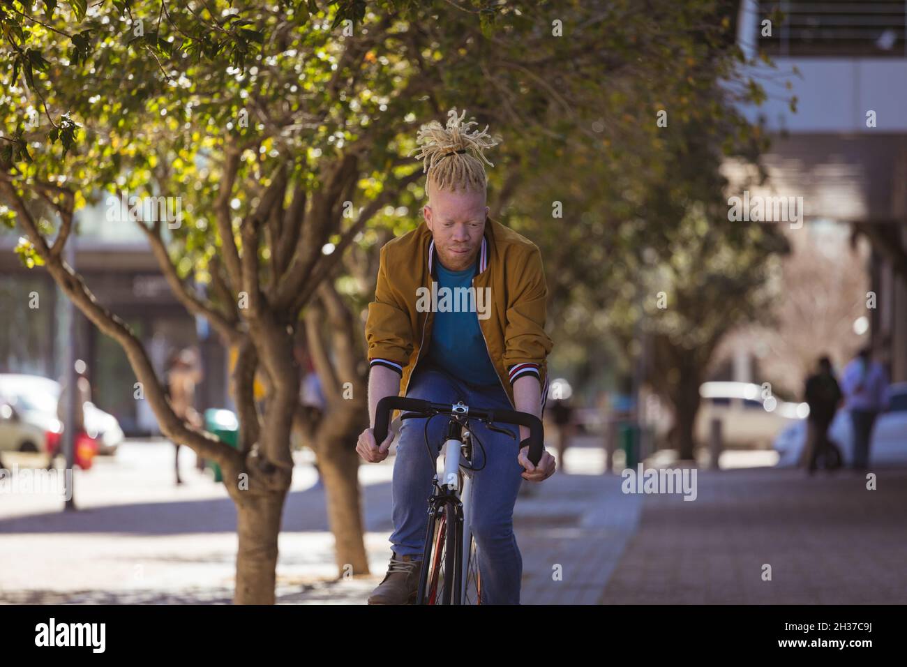 African albino man hi-res stock photography and images - Alamy