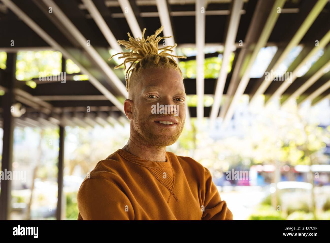 Portrait of smiling albino african american man with dreadlocks looking ...