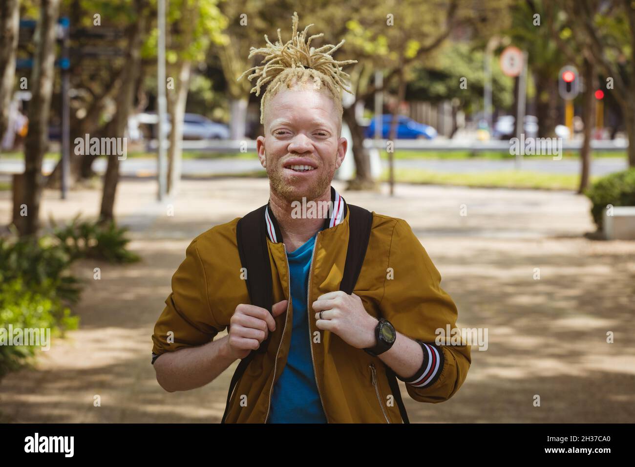 Portrait of smiling albino african american man with dreadlocks looking ...