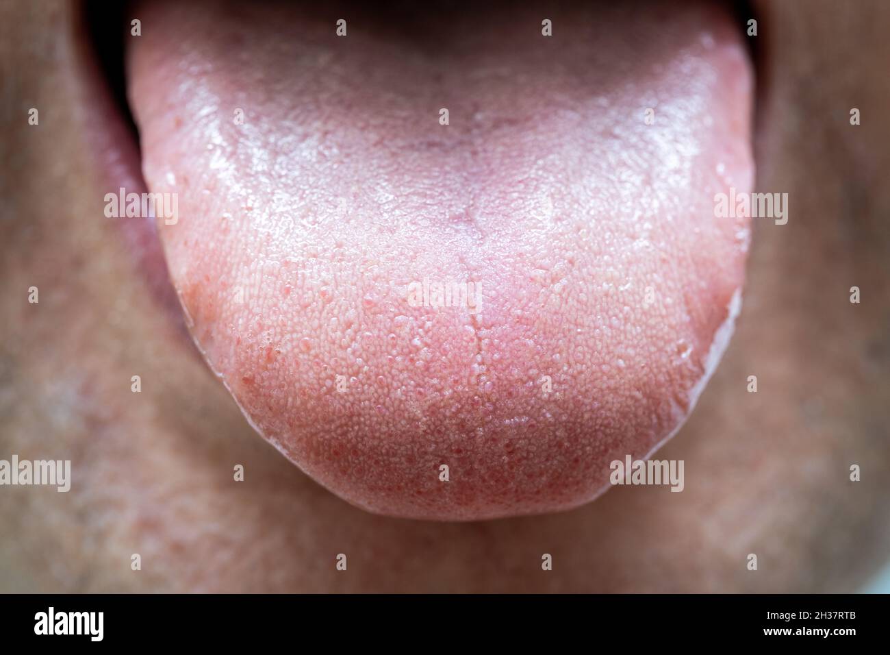 Oral health assessment hi-res stock photography and images - Alamy