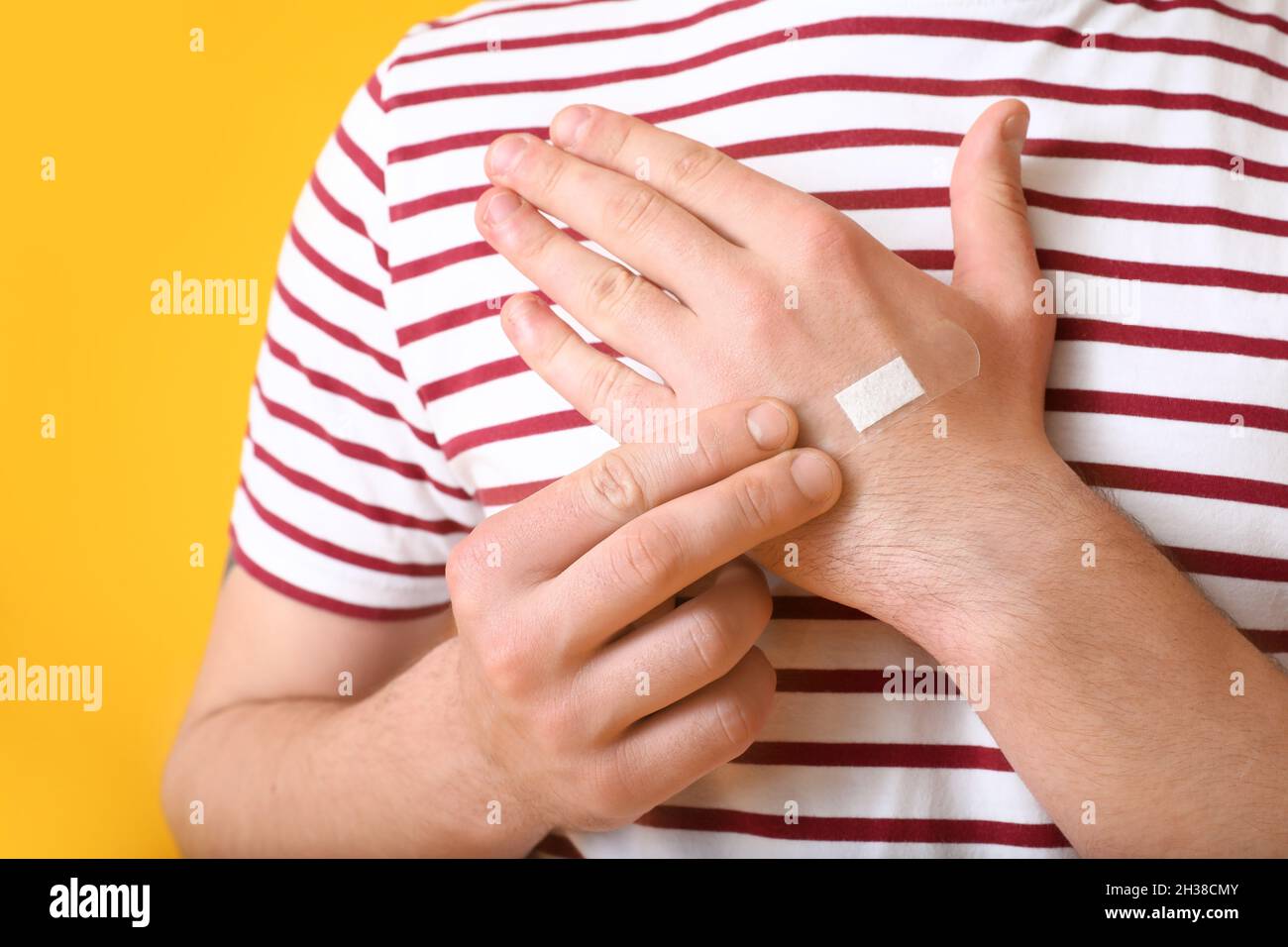 Abscess hand hi-res stock photography and images - Alamy