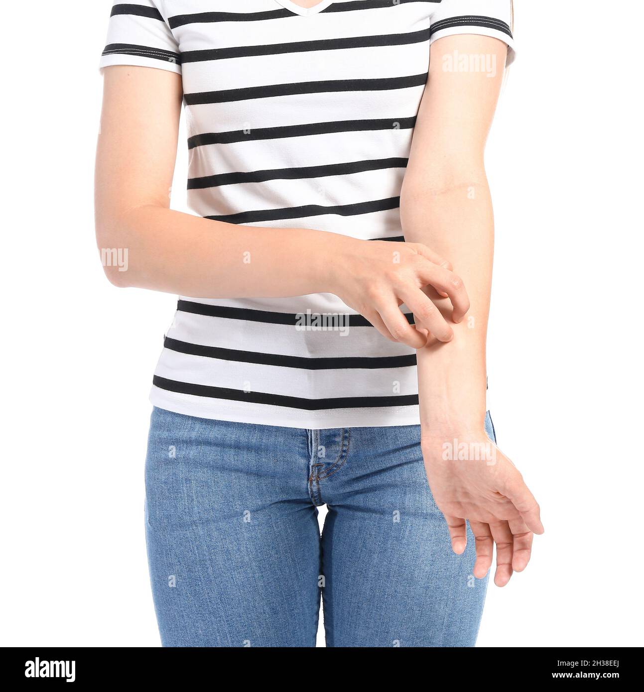 Young woman scratching herself on white background Stock Photo - Alamy