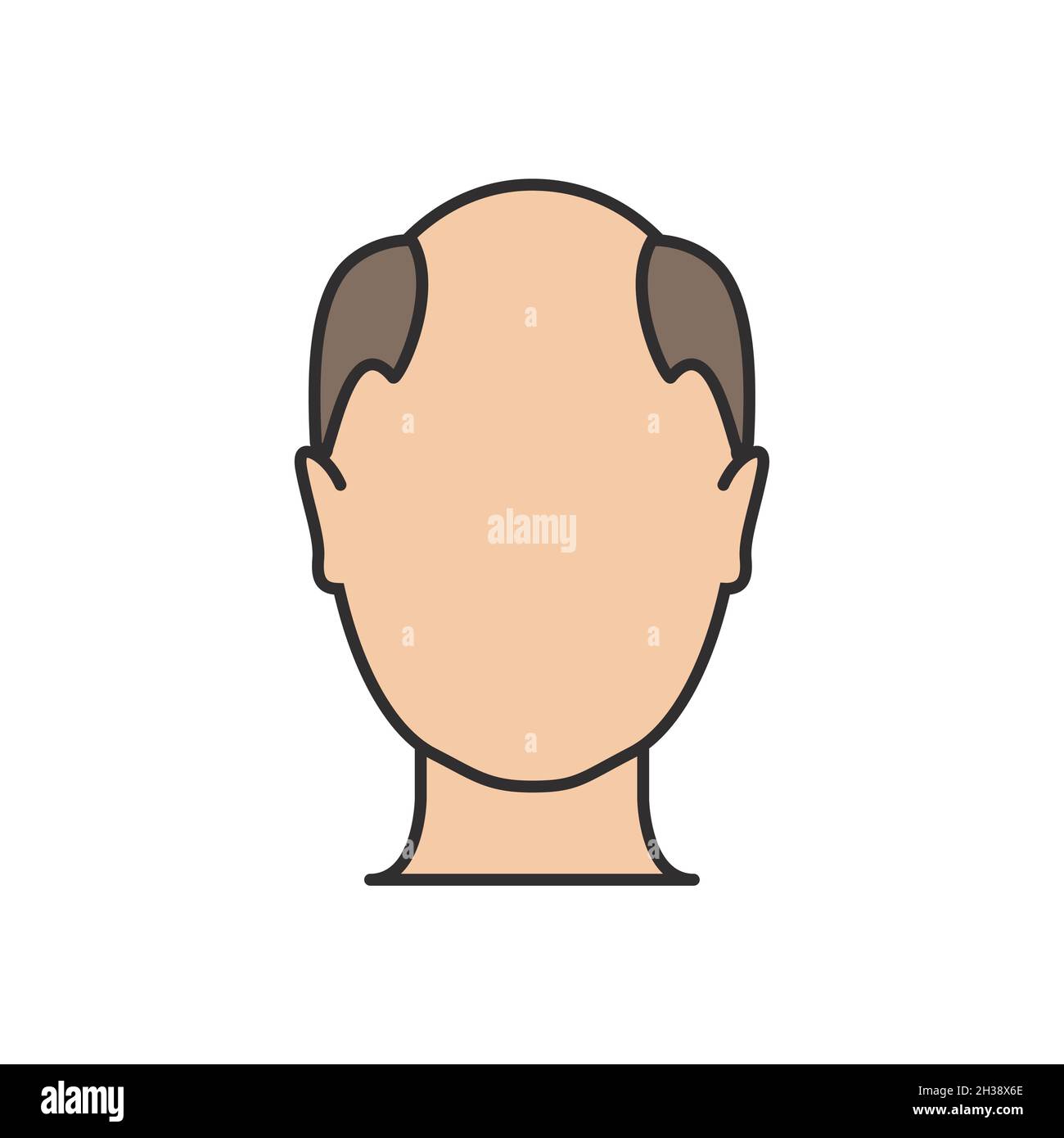 Hair loss man icon cartoon vector logo. Hair loss male scalp bald ...
