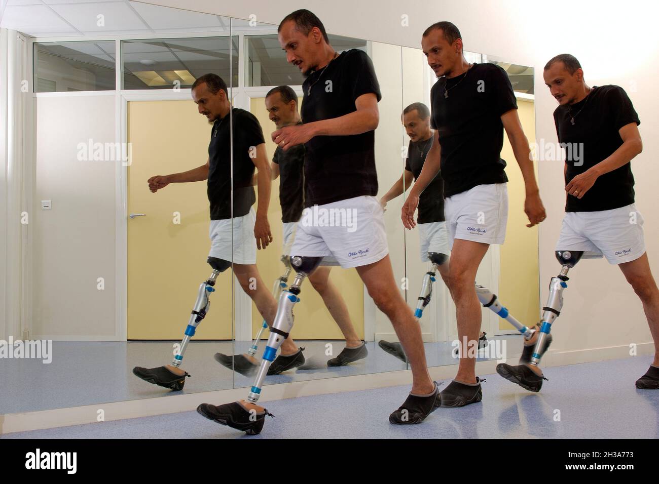 FRANCE. THE WALKING PROCESS (STEPS) OF A PATIENT WITH A C-LEG KNEE ...