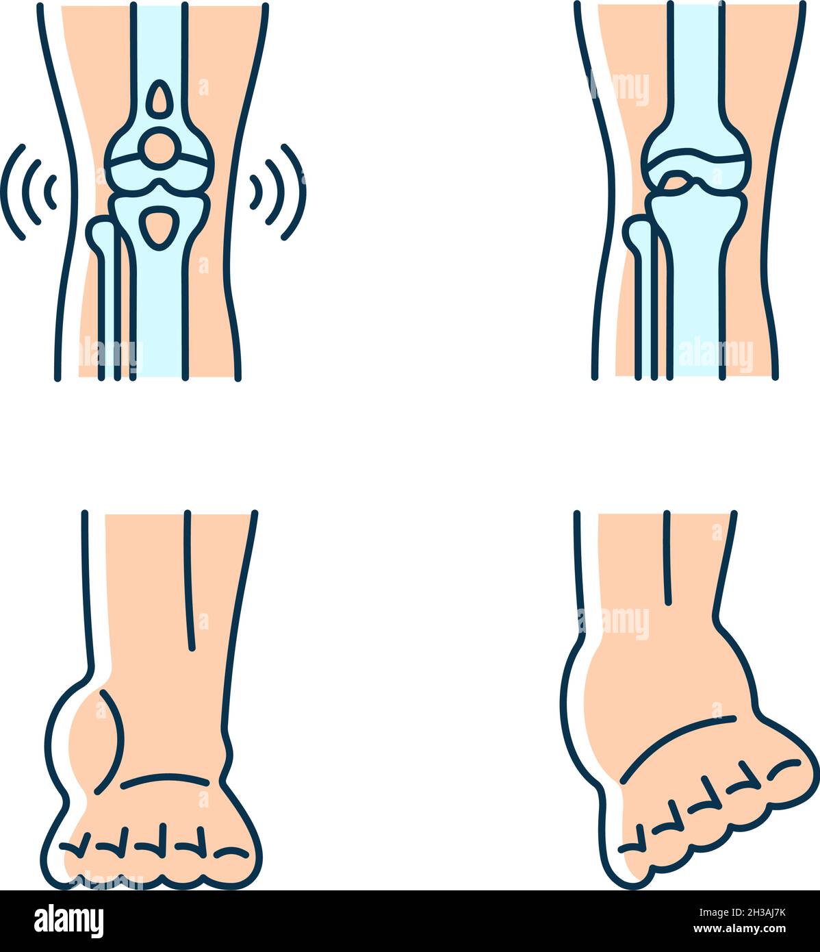 Arthritis leg pain RGB color icons set Stock Vector Image & Art - Alamy