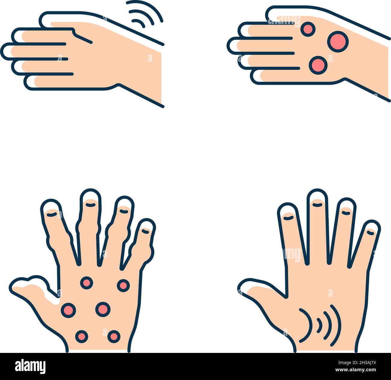 Wrist osteoarthritis Stock Vector Images - Alamy