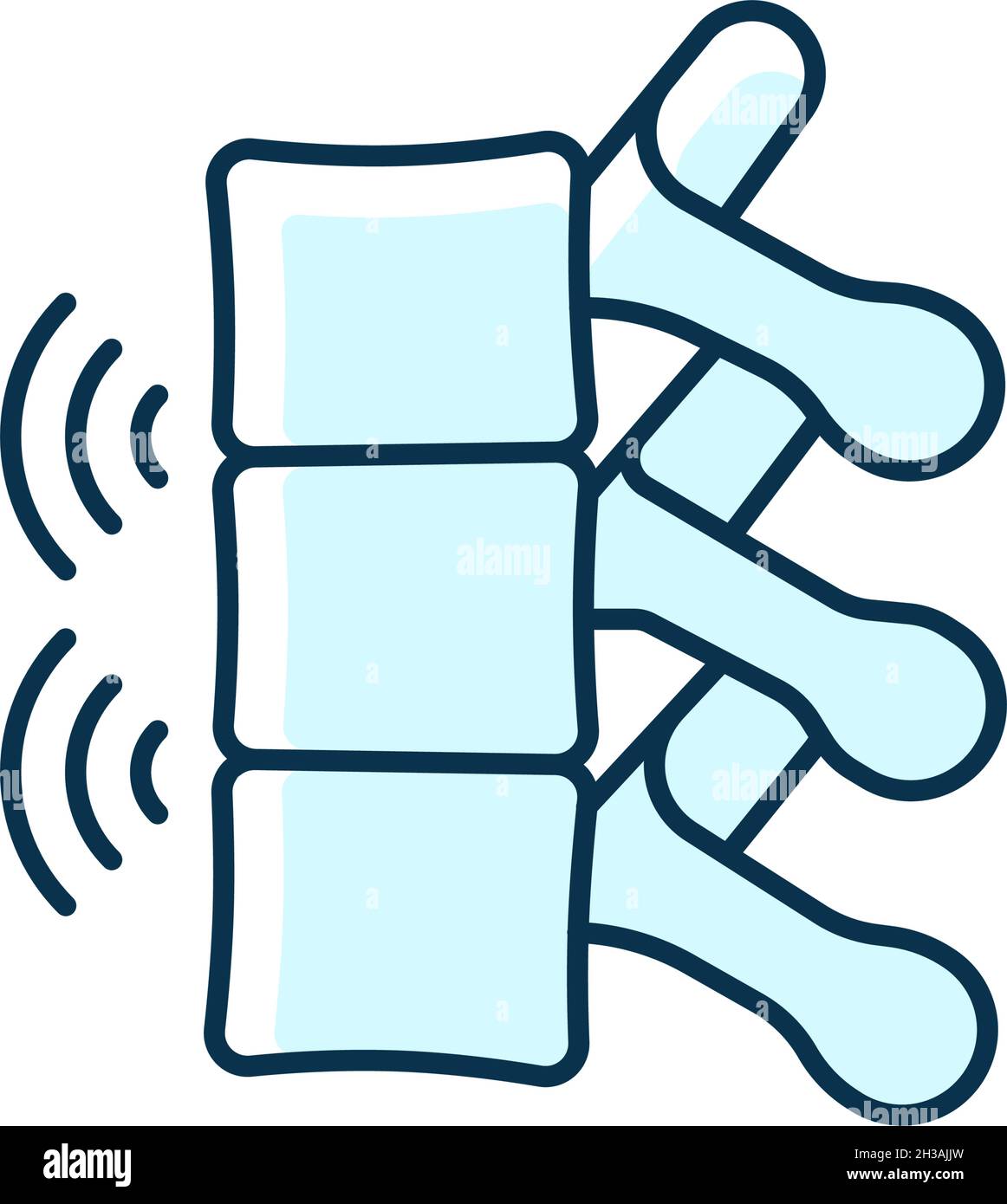 Spinal arthritis spondylitis hi-res stock photography and images - Alamy