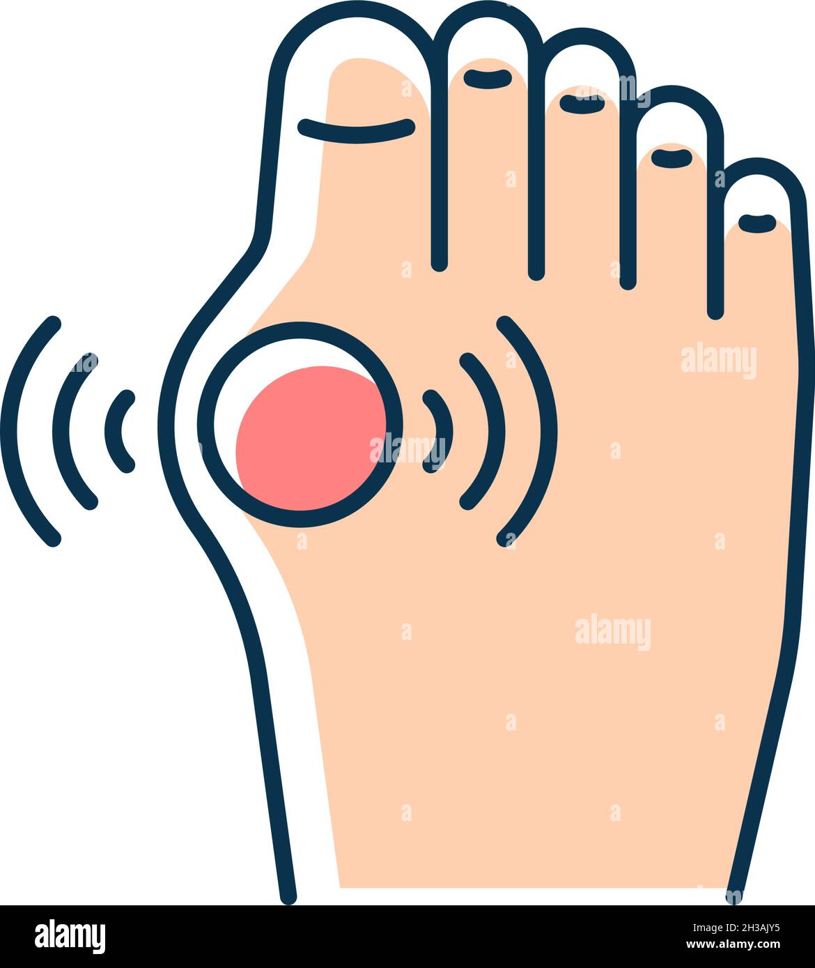 Painful gout Stock Vector Images - Alamy