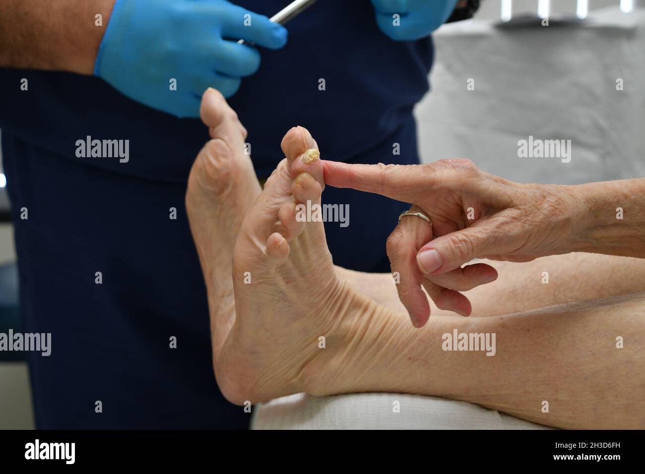 Woman doctor feet hi-res stock photography and images - Alamy
