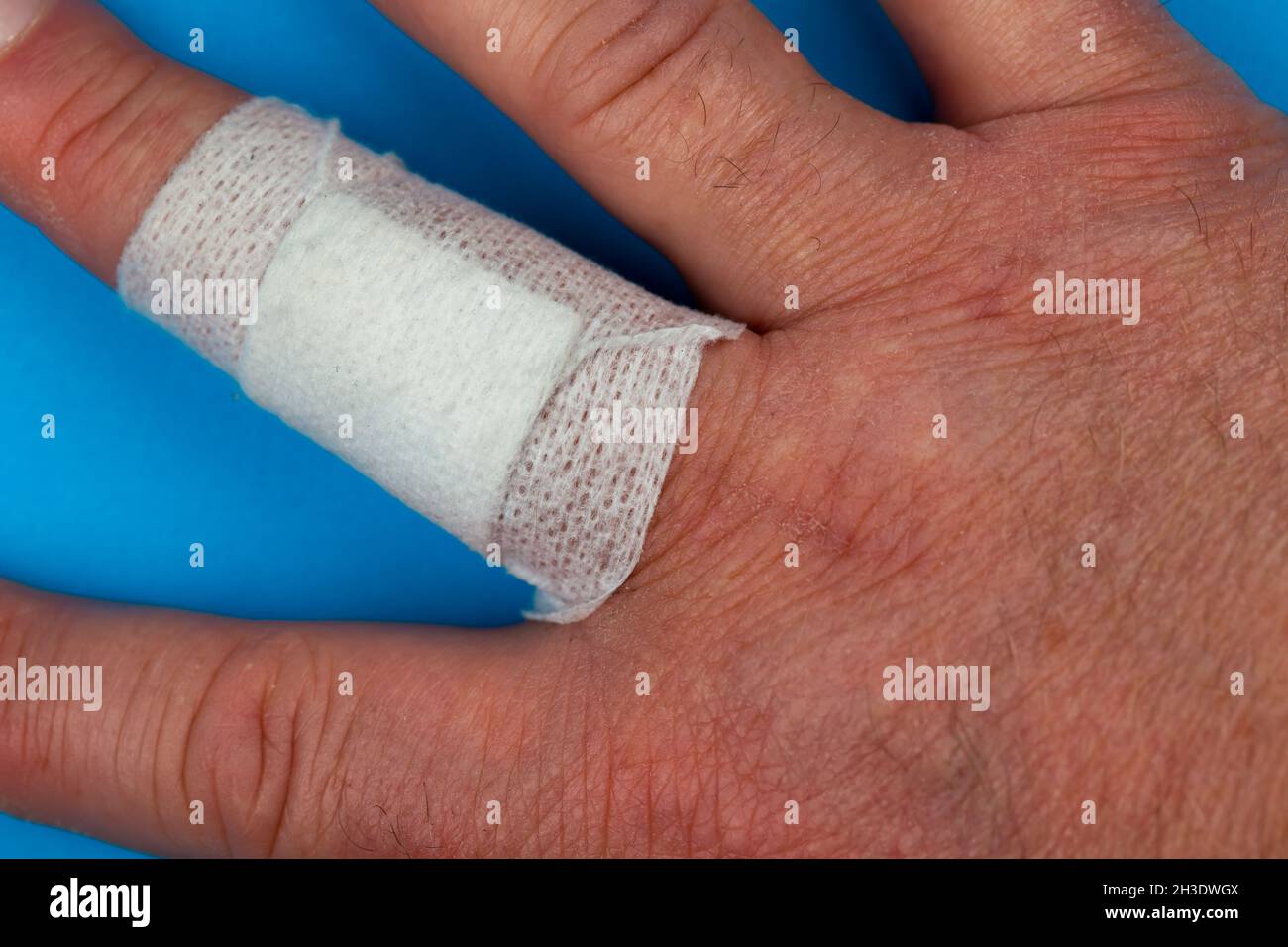Wound dressing hi-res stock photography and images - Alamy