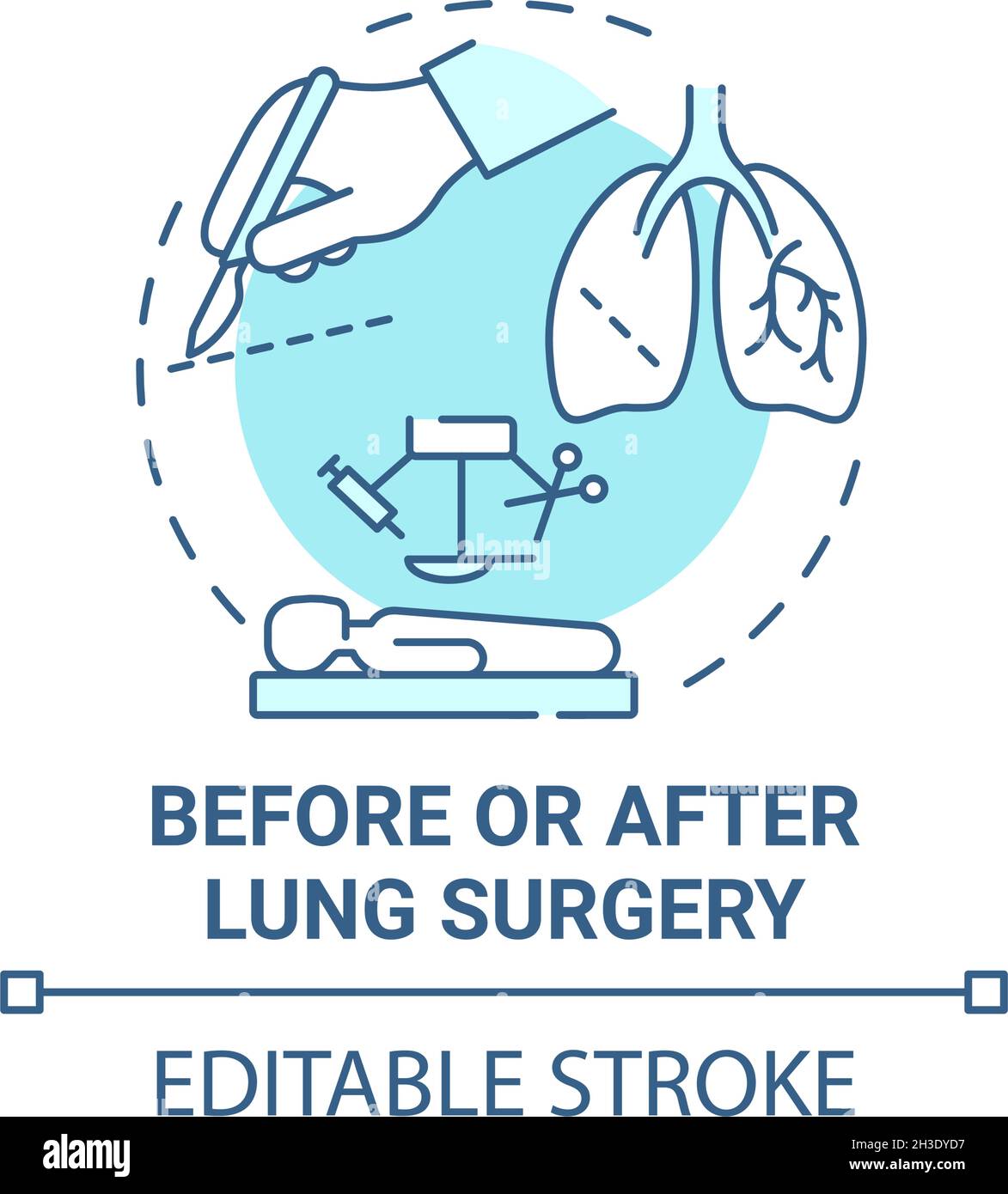 Before and after lung surgery blue concept icon Stock Vector Image ...