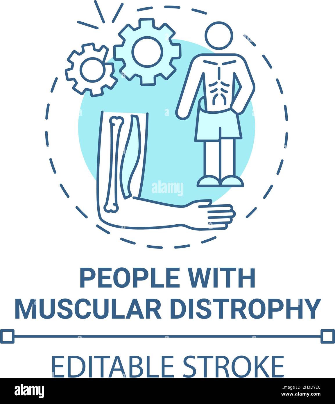 Muscular dystrophy muscle Stock Vector Images - Alamy