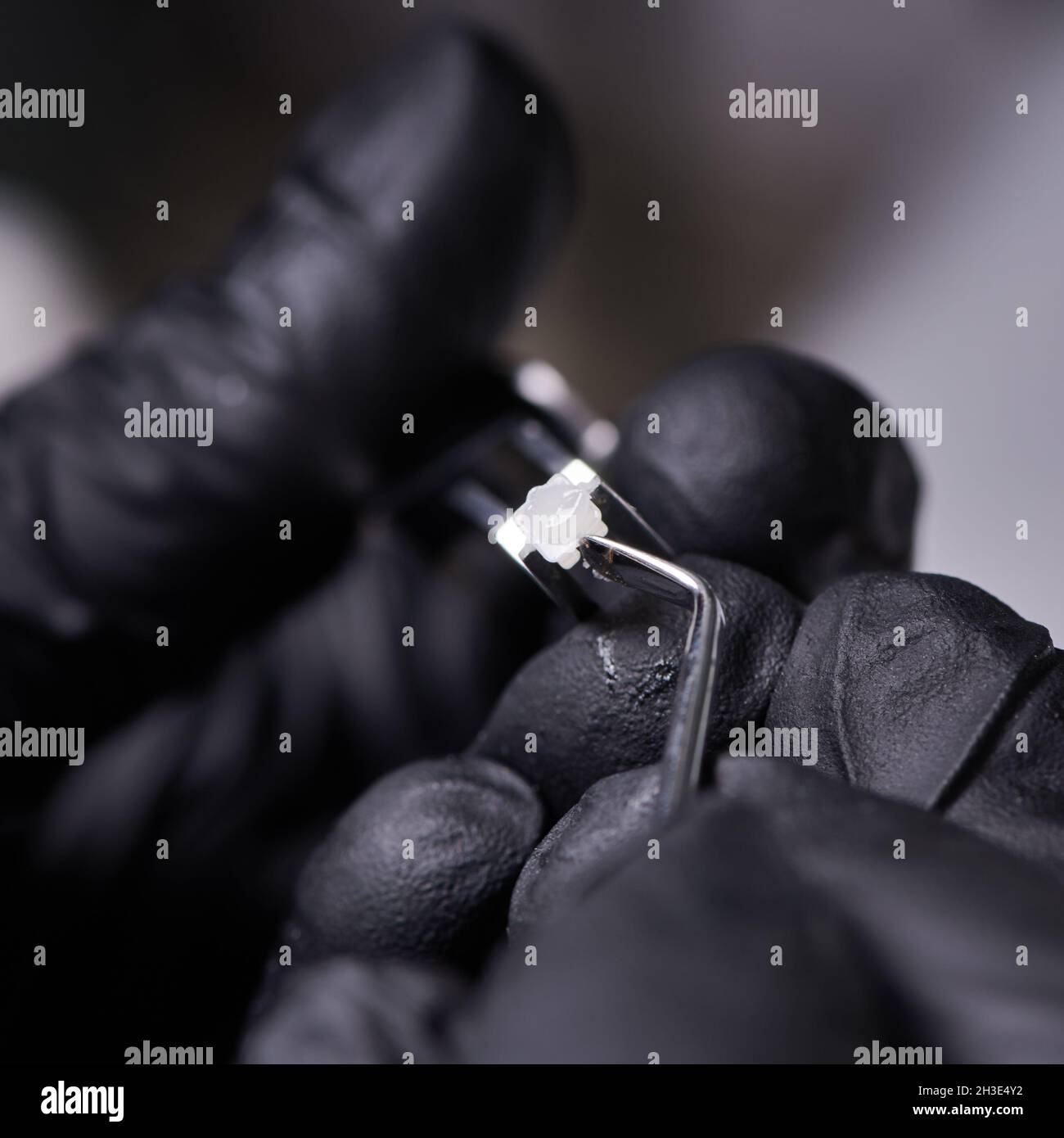 Close up of orthodontist in black sterile glove putting adhesive paste ...