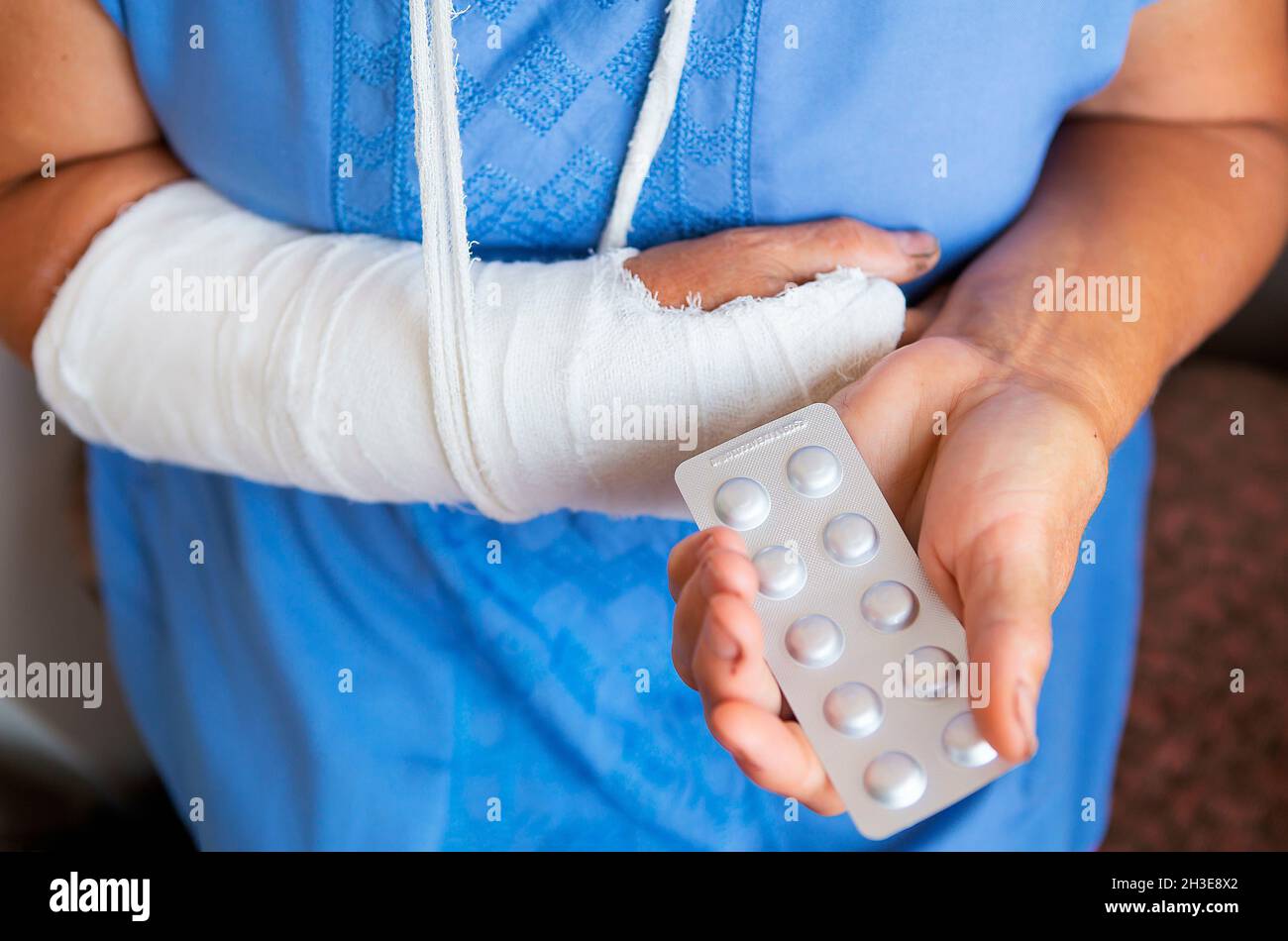 A senior retired woman with a rewound arm in a cast and a bandage holds ...