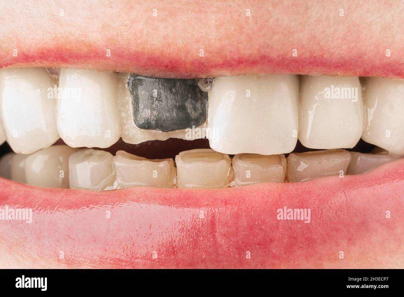 Ceramic and metal hi-res stock photography and images - Alamy