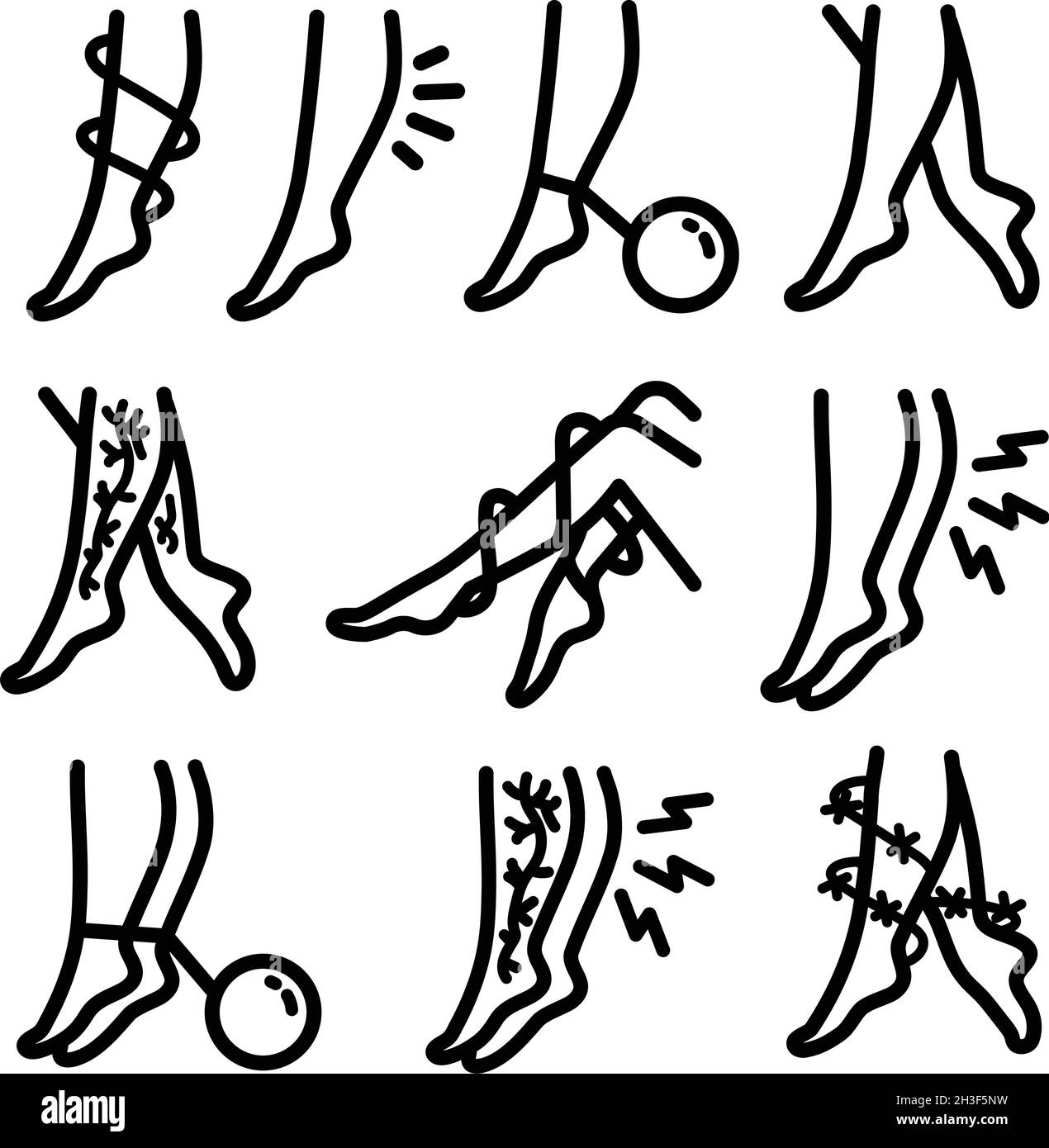 Varicose Disease Collection Icons Set. Varicose Symptoms And Treatment ...