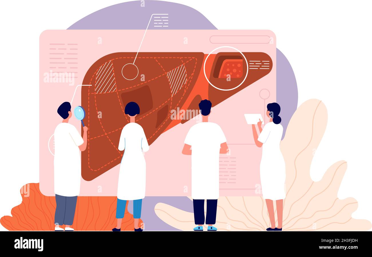 World hepatitis day. Liver cirrhosis, medicine disease awareness ...