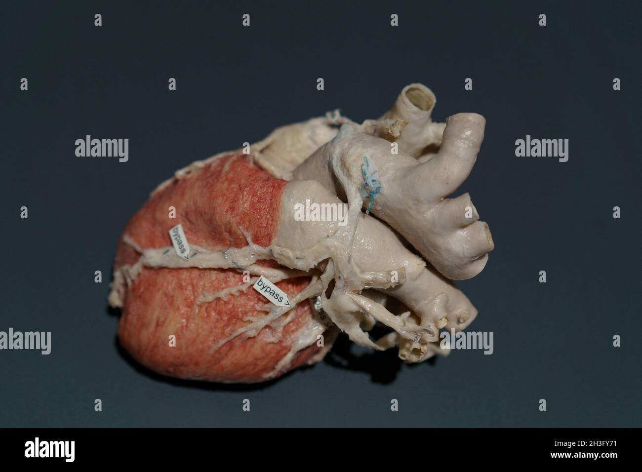 Live Human Dissection