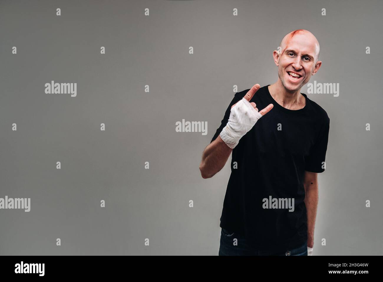 Battered hands hi-res stock photography and images - Alamy