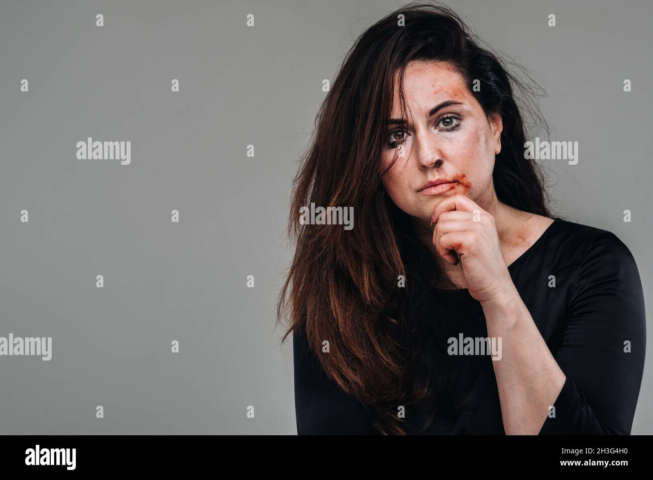 Battered Woman Battered Woman Black Eye High Resolution Stock ...