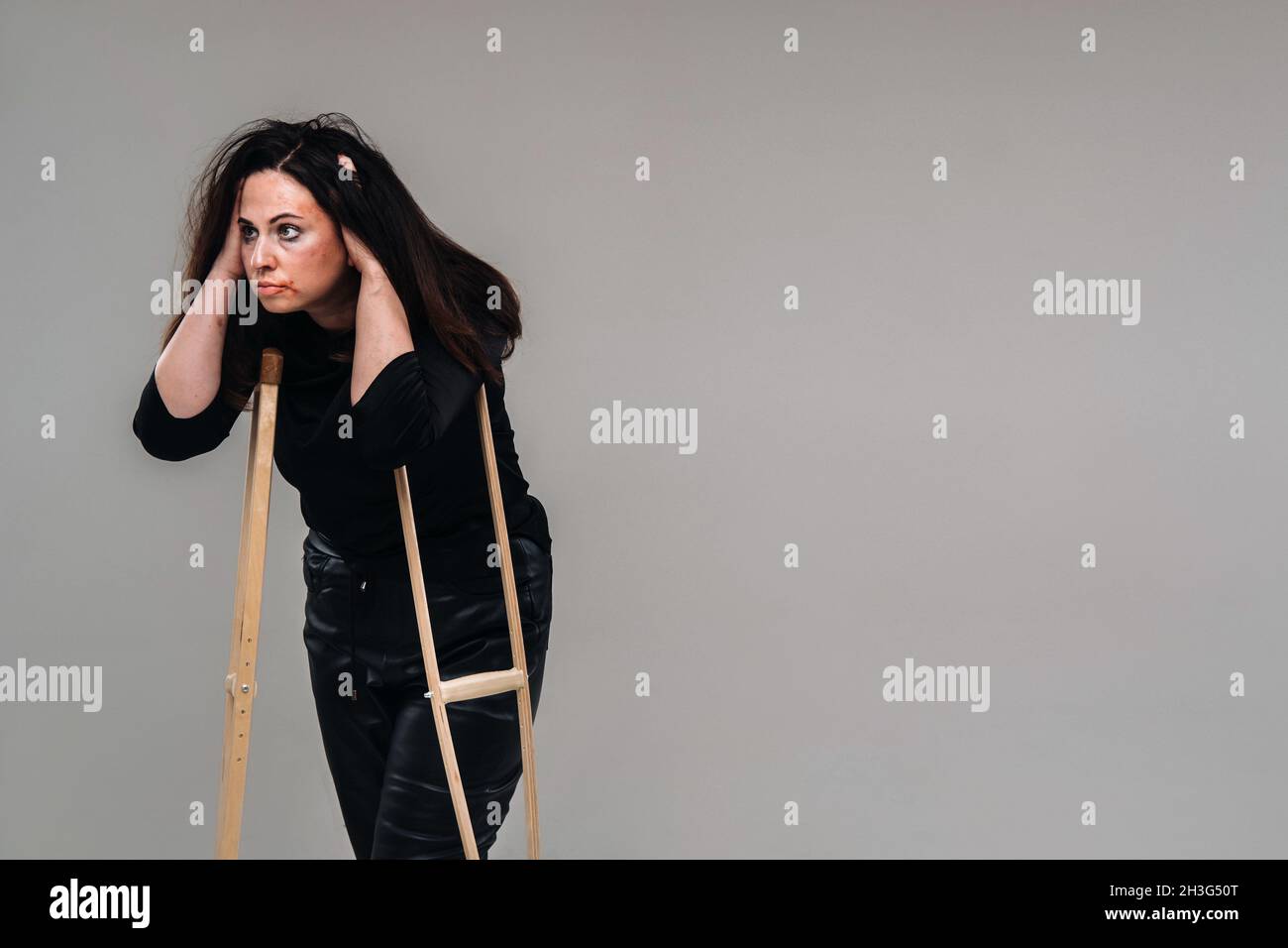 Battered hands hi-res stock photography and images - Alamy