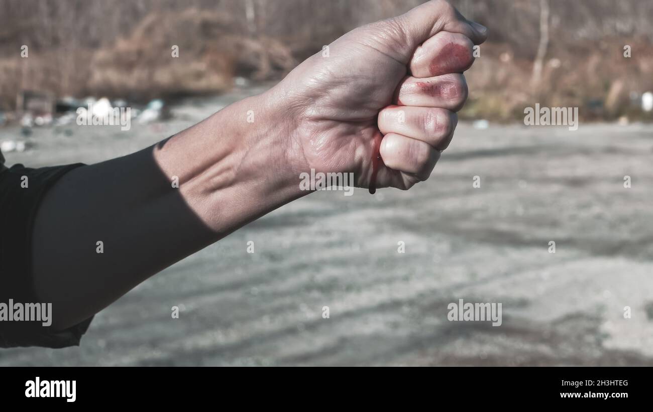 the man 's hand is covered in blood , blood is dripping from the ...