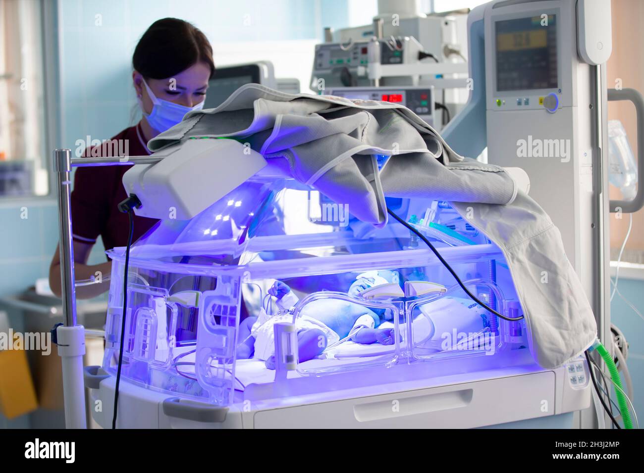 Neonatal jaundice hi-res stock photography and images - Alamy