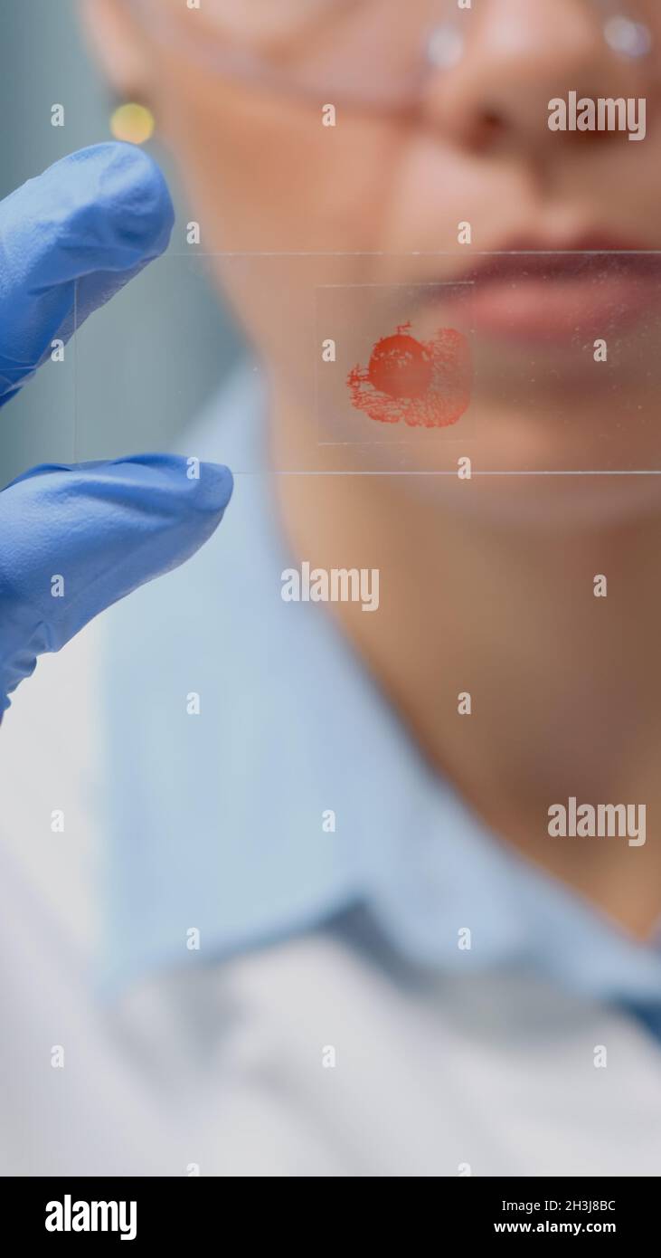 Close up of hand holding glass tray with blood for test experiment in ...