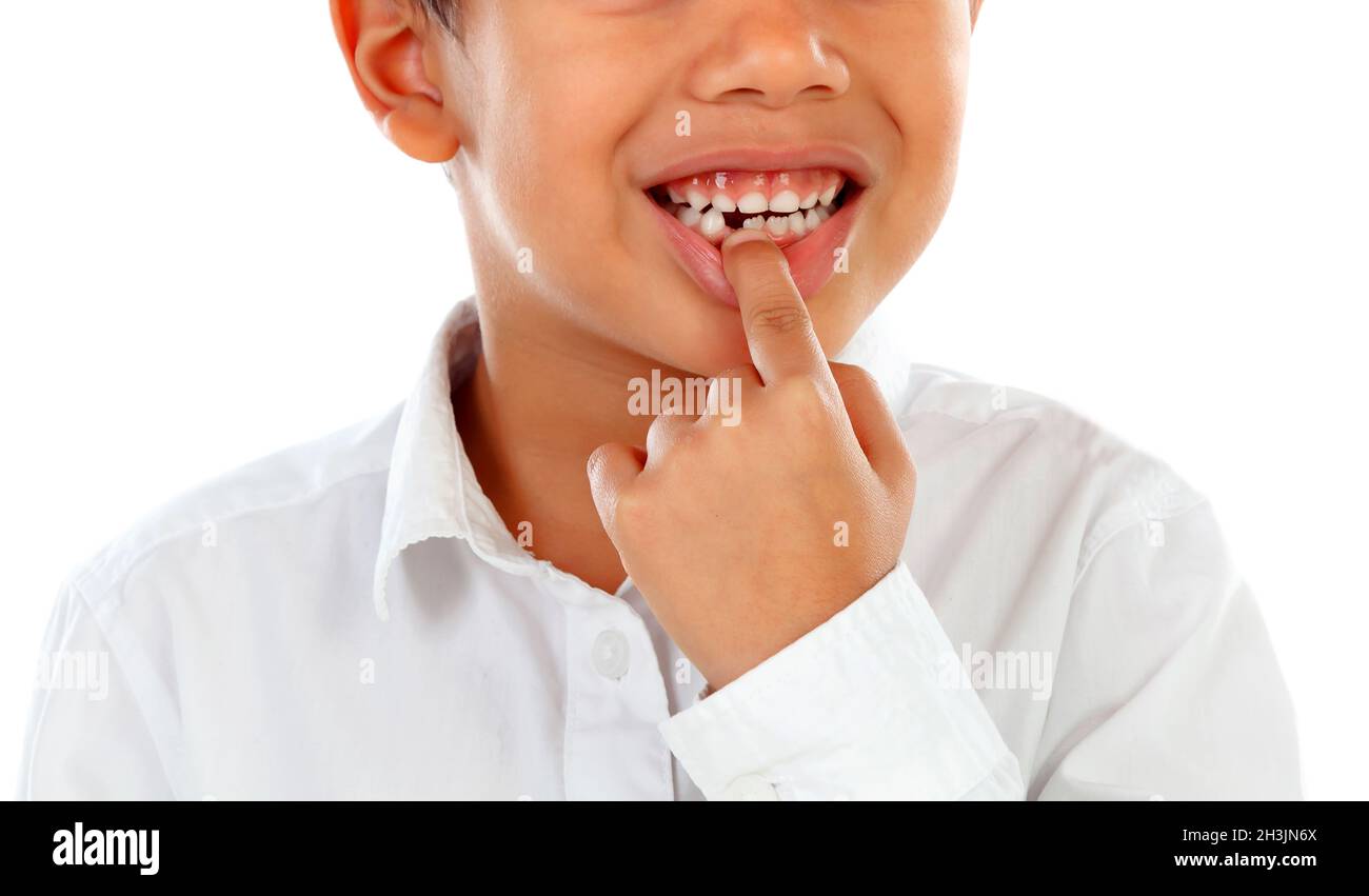 Litttle boy showing his teeth isolated on a white background Stock ...