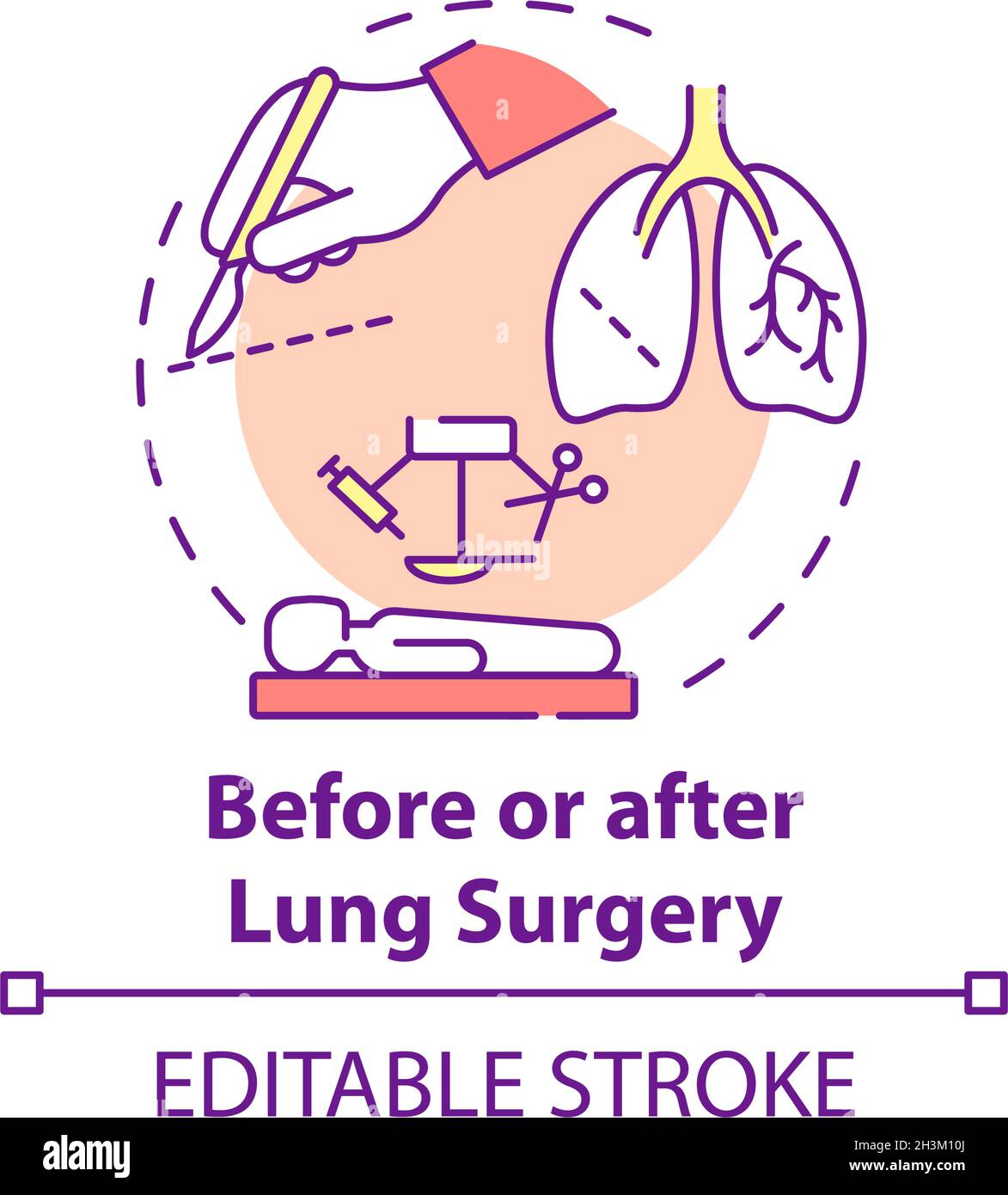 Before and after lung surgery concept icon Stock Vector Image & Art - Alamy